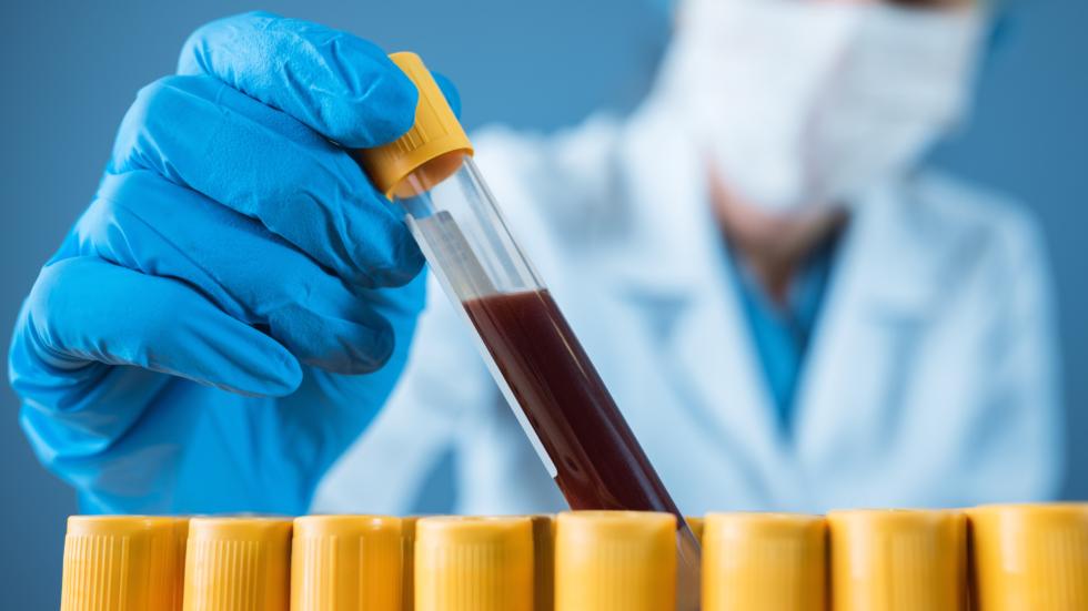 Whole Blood Stability Determination- BioPharma Services