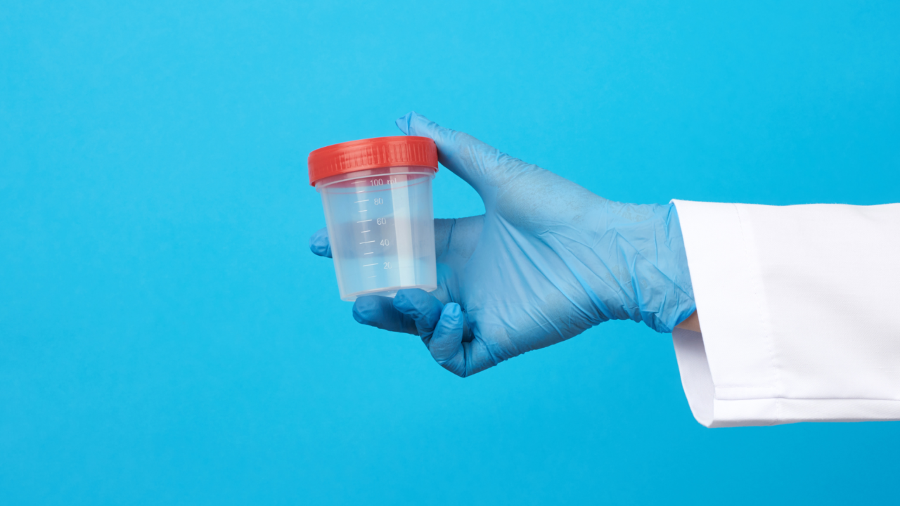 BA Method Development: Urinalysis - BioPharma Services