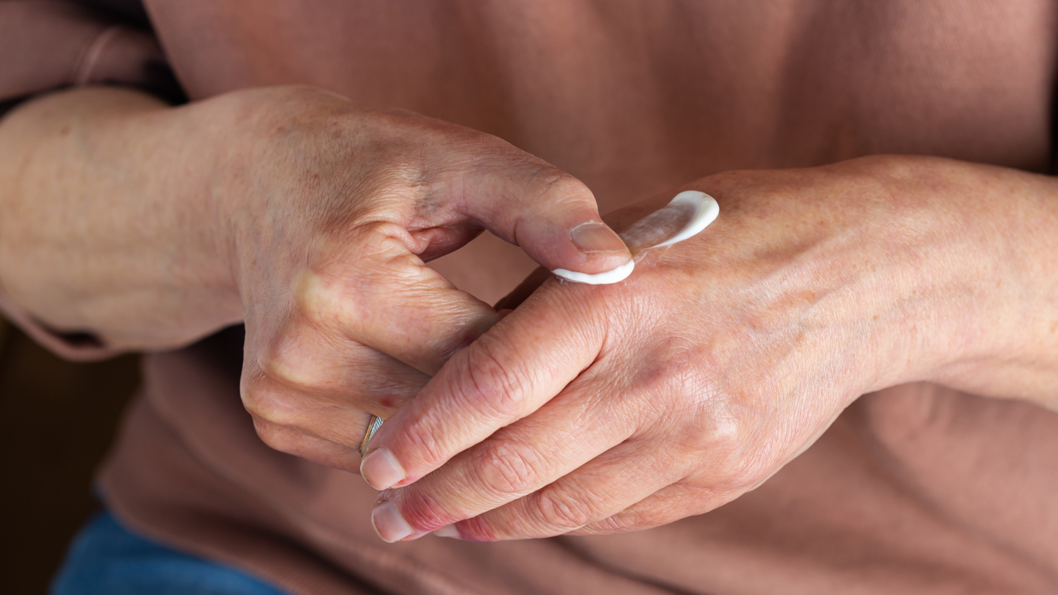 Bioequivalence Vasoconstriction Assay Studies for Topical ...